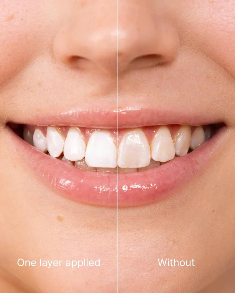 Tooth Polish - Instant Clean Smile – Snooterll